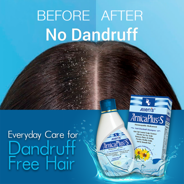 ArnicaPlus S - Anti Dandruff Shampoo | Allen Laboratories